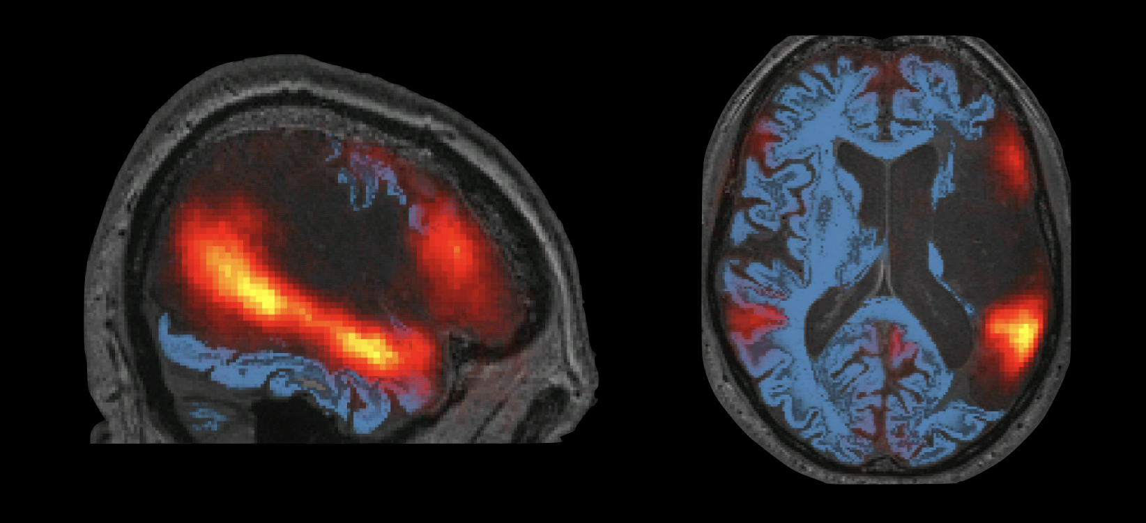 The language network is recruited but not required for nonverbal event ...